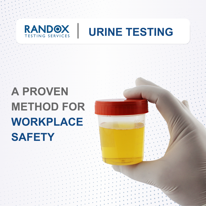 Urine Testing - the Matrix of Choice for Random Drug Testing